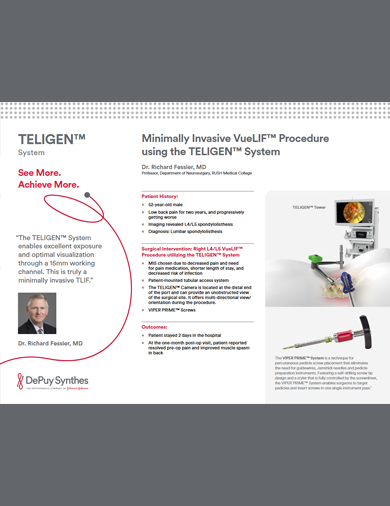 MIS TLIF Procedure using the TELIGEN™ System - Richard Fessler, MD ...