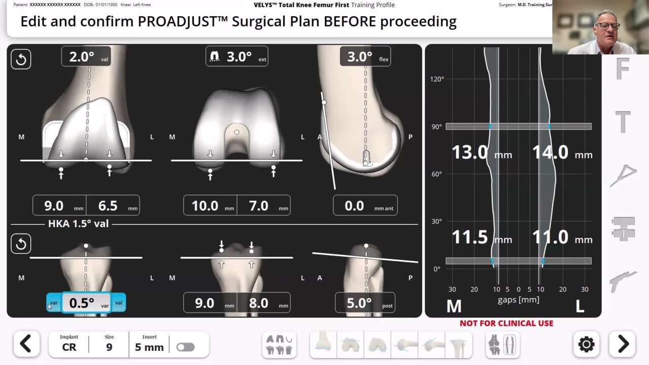 VELYS Robotic-Assisted Solution Case Walkthrough with Dr. Christopher ...
