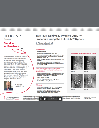 Two-level MIS TLIF Procedure using the TELIGEN™ System - Wissam ...