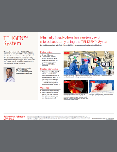 Minimally invasive Hemilaminectomy with Microdiscectomy using the ...